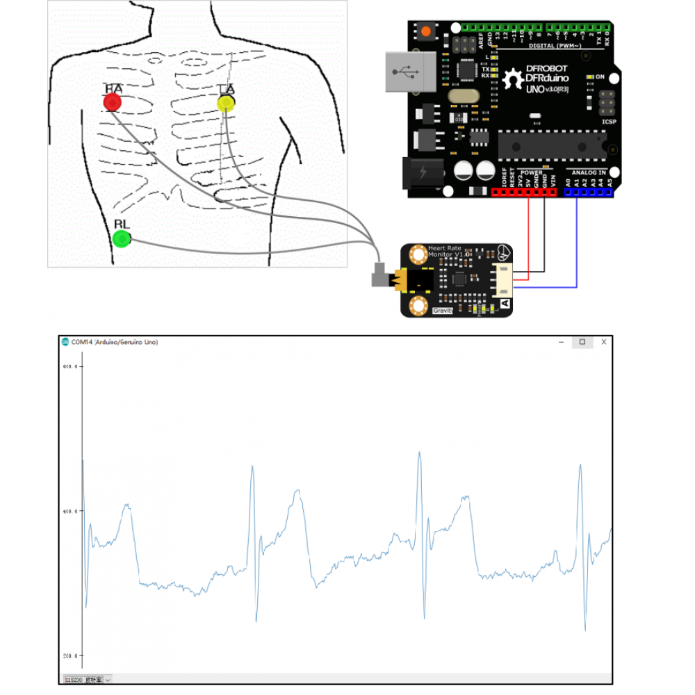 Gravity: Analog Heart Rate Monitor Sensor (ECG) For Arduino